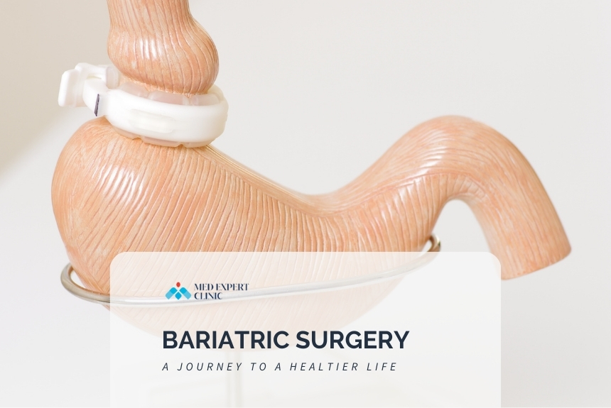 Bariatric Surgery: A Journey to a Healthier Life - Med Expert Clinic