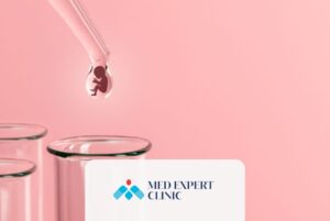 FSH, LH, PRL, TSH, AMH, and Oestradiol in IVF Preparation - Med Expert ...