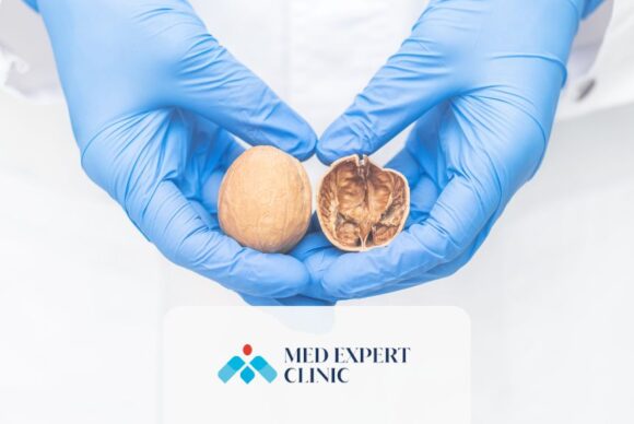 Testicular Health and Its Importance in Male Fertility - Med Expert Clinic